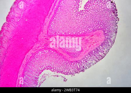 Human vermiform appendix cross section showing (left to right) serous ...