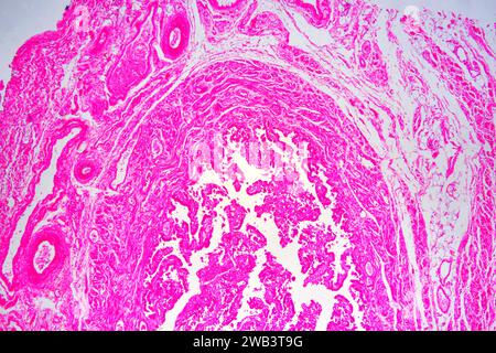 Human Fallopian tube section. X30 at 10 cm wide Stock Photo - Alamy