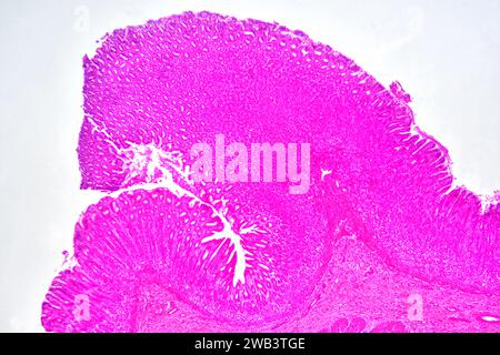 Light micrograph if the mucosa of the stomach in the region of the ...