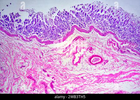 Fundic region stomach (cross section) showing mucosa, submucosa ...
