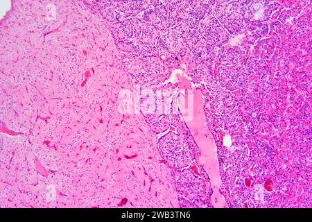 Pituitary gland, light micrograph Stock Photo - Alamy
