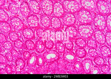 Human large intestine (colon) showing mucosa with Lieberkhun crypts ...