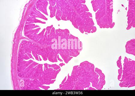 Human small intestine (jejunum) showing from left to right: serosa ...