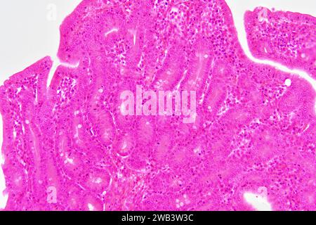 Human small intestine (jejunum) showing from left to right: serosa ...