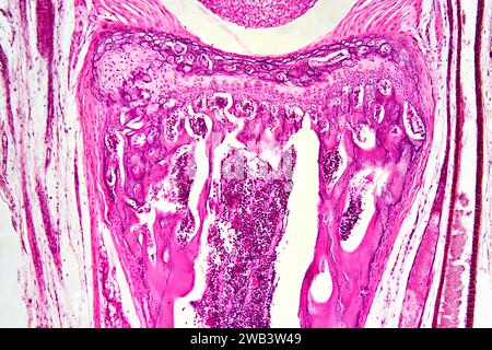 Human red bone marrow, hematopoietic press. The big tsit beetveen ...