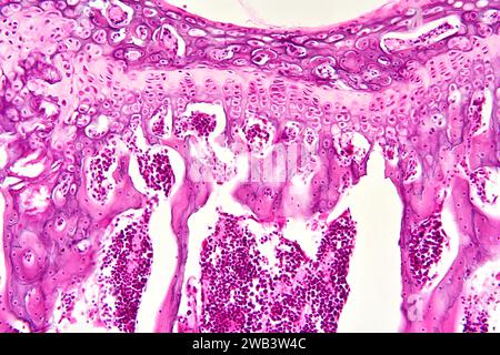 Human red bone marrow, hematopoietic press. The big tsit beetveen ...