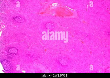 Human spleen (lymphatic organ) showing capsules, red pulp, white pulp ...