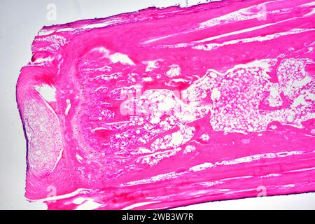 Tendon. Light micrograph of a longitudinal section through normal human ...