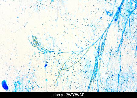 Human motor neurons (endings). X75 at 10 cm wide Stock Photo - Alamy