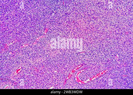 Human senile ovary with spindle-shaped stroma cells. X25 at 10 cm wide ...