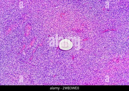 Human senile ovary with spindle-shaped stroma cells. X25 at 10 cm wide ...