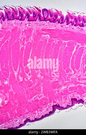 Filiform papillae in a tongue longitudinal section. X25 at 10 cm wide ...