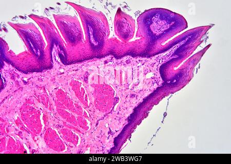 Filiform papillae in a tongue longitudinal section. X25 at 10 cm wide ...
