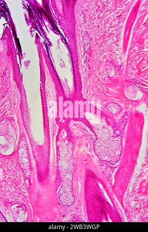 Human sebaceous gland, light micrograph. Sebaceous glands are holocrine ...