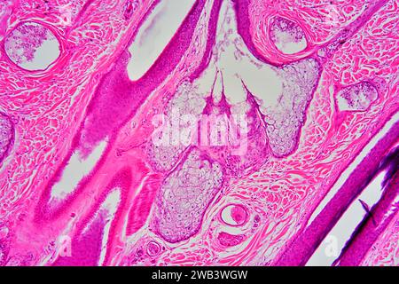 Human sebaceous gland, light micrograph. Sebaceous glands are holocrine ...