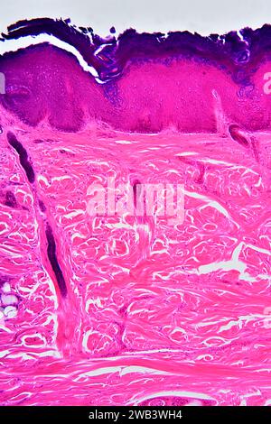 Skin. Light micrograph of epithelial tissue from the skin. Human finger ...