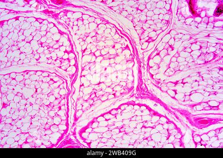 Human adipose tissue of hand. X25 al 10 cm wide Stock Photo - Alamy