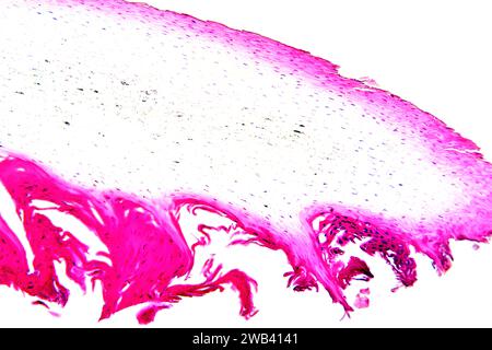 Human nail section showing dermis, nail matrix and nail plate of hard ...