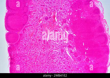 Lymph node or lymph gland with capsule, lymphoid nodule and trabeculae ...