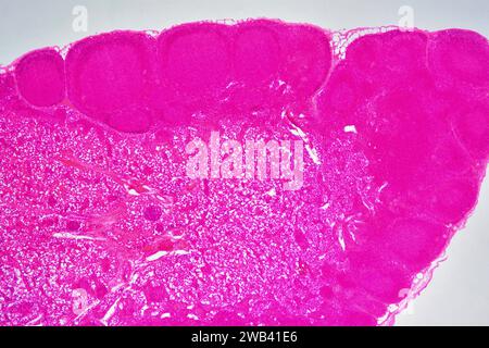Lymph node or lymph gland with capsule, lymphoid nodule and trabeculae ...