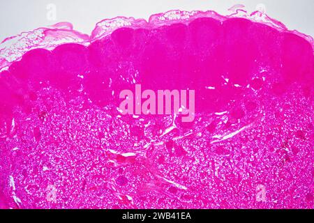 Lymph node or lymph gland with capsule, lymphoid nodule and trabeculae ...