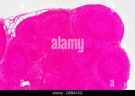 Lymph node or lymph gland with capsule, lymphoid nodule and trabeculae ...