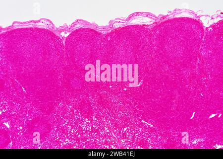Lymph node or lymph gland with capsule, lymphoid nodule and trabeculae ...