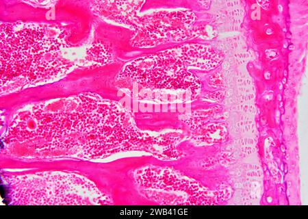 Red marrow (bone marrow) is an hematopietic organ. Photomicrograph X75 ...