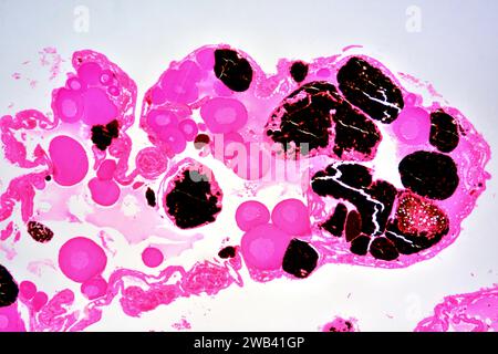 Frog ovary showing oogonias, immature oocytes, mature oocytes, germinal ...