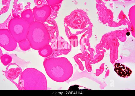 Frog ovary showing oogonias, immature oocytes, and mature oocytes ...