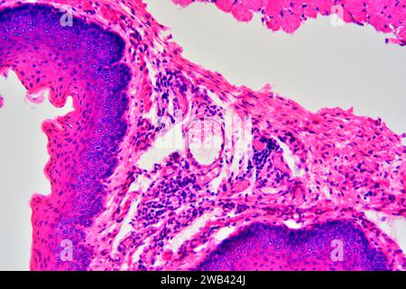 Vein surrounded by connective tissue and epithelium (left ...