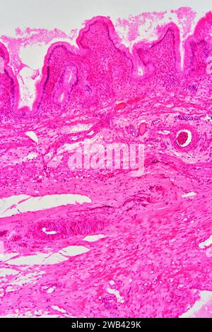 Gallbladder wall showing columnar epithelium with mucosal folds ...