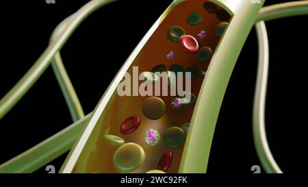 Sulfhemoglobinemia, a condition characterized by abnormally high levels ...