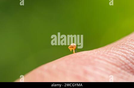 bee sting close-up stuck into human skin after being bitten by a ...