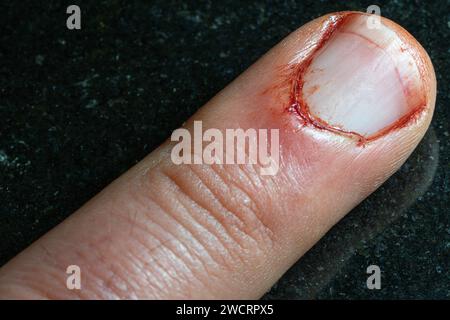 index finger of human hand injured with blood residue Stock Photo - Alamy