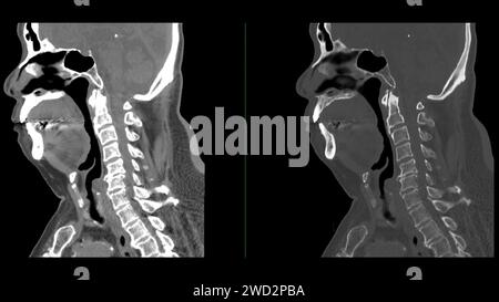 A CT scan of the neck sagittal view for diagnostic technique is ...