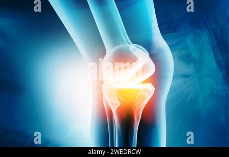 Anatomy of knee joint on medical background. 3d illustration Stock ...