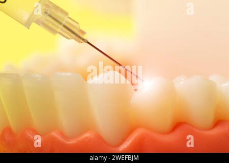 Injection of an anesthetic drug into the gum of a diseased tooth for ...