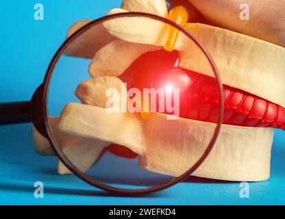 Intervertebral hernia of the lumbar spine under a magnifying glass ...
