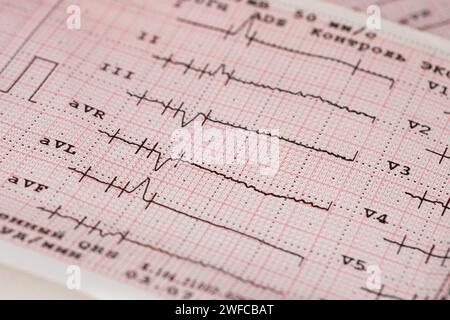 heart rhythm ekg note on paper Doctors use it to analyze heart disease ...