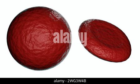 Red blood cells with spherocytosis Stock Photo - Alamy