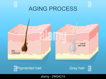 aging process. Graying hair. Melanin depletion and Hair follicle ...
