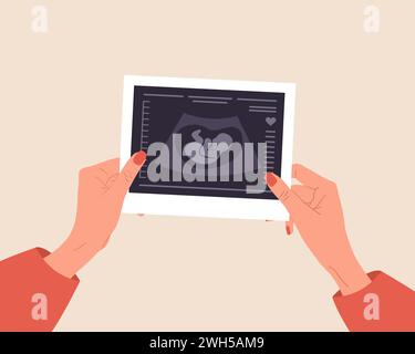 Fetus in mother hands, baby birth, embryo and woman palms, vector Stock ...