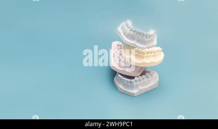 Many Die Stone, Plaster Cast Molds Of The Upper And Lower Jaws And ...