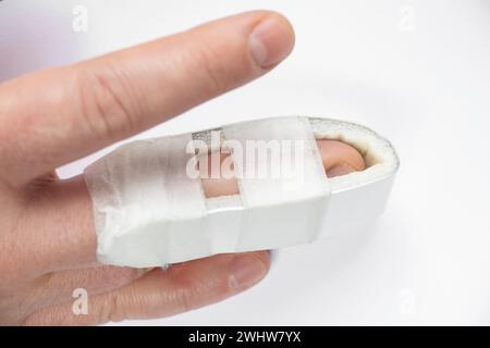A man's hand with a broken finger and a splint placed on a broken ...