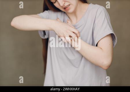 Allergy dermatology scabies itches skin problem woman Stock Photo - Alamy