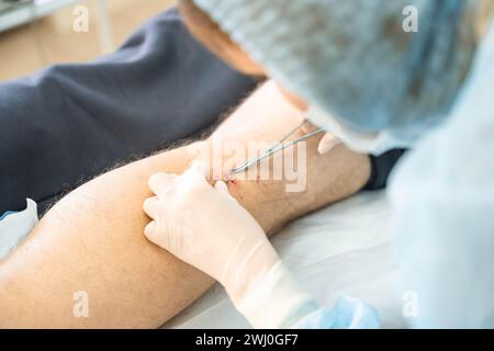 Dermatologist surgeon stitching up a wound after surgery, close up view ...
