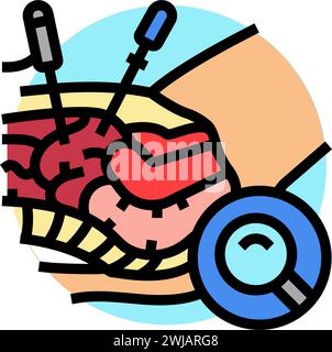 laparoscopy surgery hospital line icon vector illustration Stock Vector ...