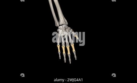 the proximal, or first bone, in the fingers when counting from the hand ...