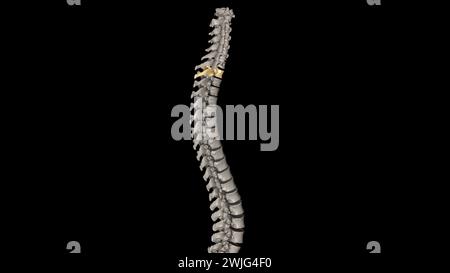 The L4 and L5 are the lowest vertebrae, or spinal bones, in the lumbar ...